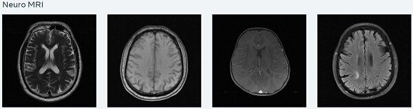 膝盖及脑神经扫描fastMRI数据集-大白智能